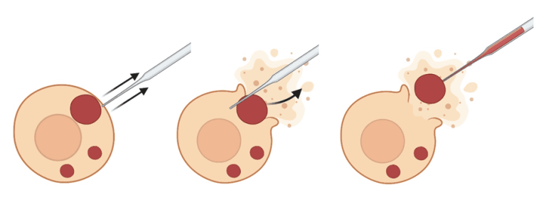 Endo-lysosomal patch clamp assay